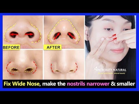 Can I fix my nose without surgery?