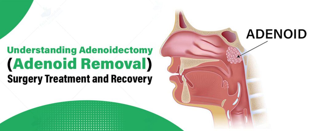 Cost Of Adenoidectomy in Hyderabad